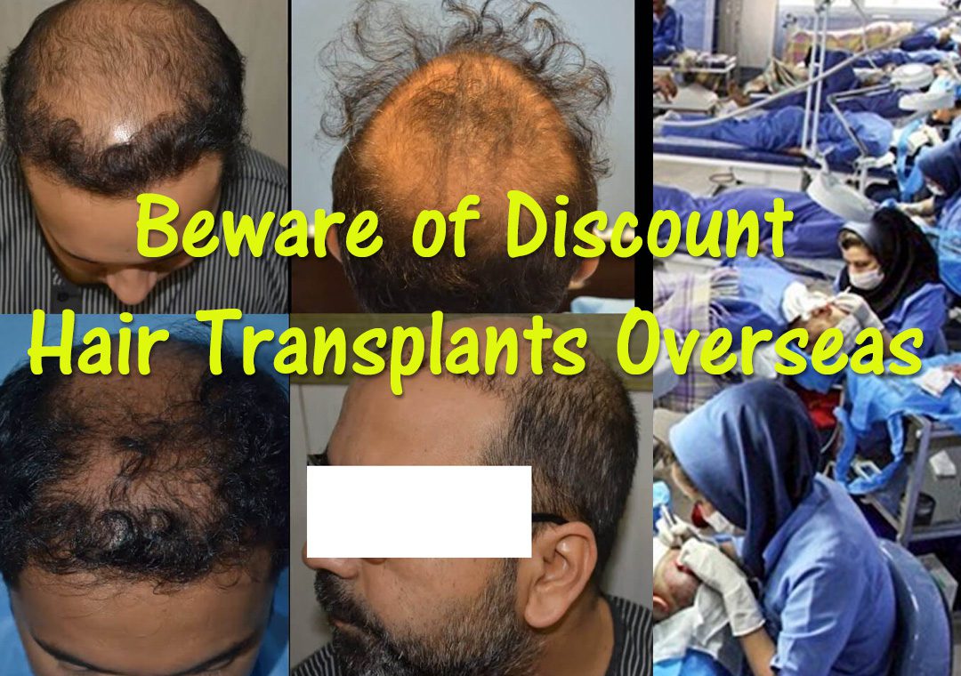 Hair Transplant Surgeon, Austin, Houston, San Antonio & Dallas, Texas (TX), Dr. Dan McGrath, FUE ...